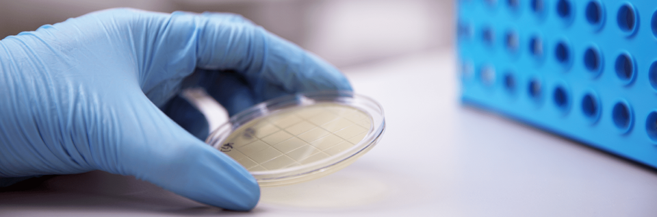 Surface Monitoring with Contact Plates - Viroxy