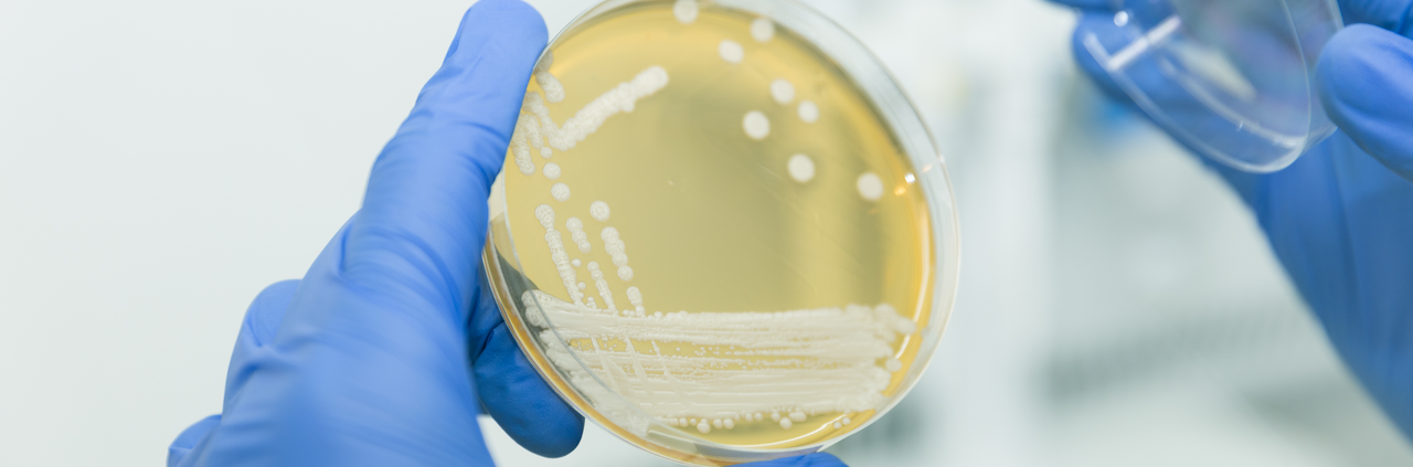 Bioburden Testing - Viroxy