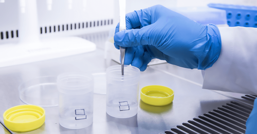 Suspension Test And Carrier Test For Disinfectants According To ...